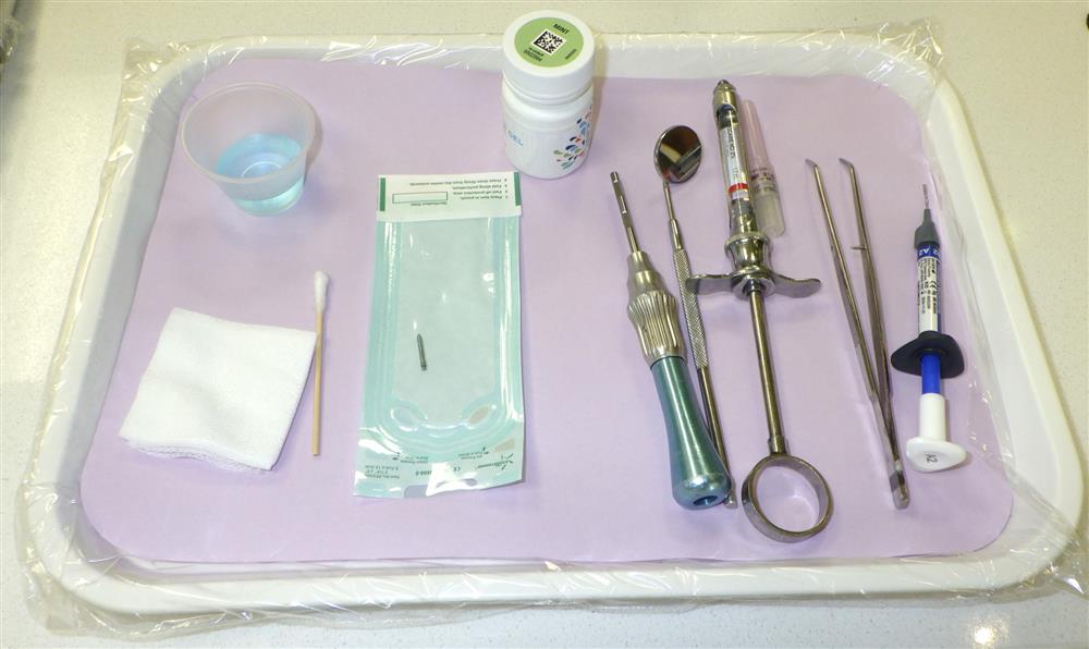 IOS Ortho. Temporary dental Implant Templant IOS USA