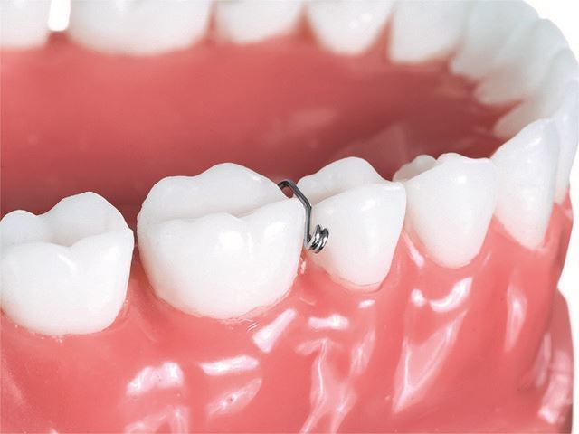 IOS Ortho. SS Separating Spring - PK/10