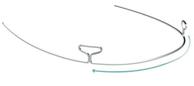 IOS Ortho. T- Loop SS Wire .016 X .022